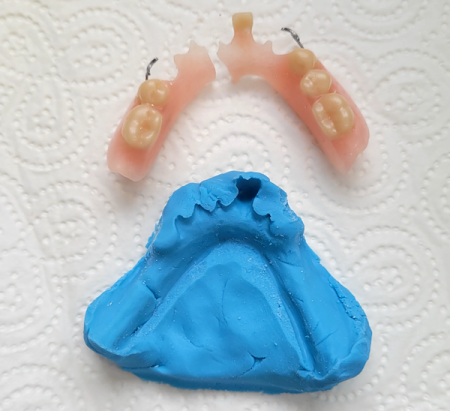 Fast Denture Repairs – Denture Repairs